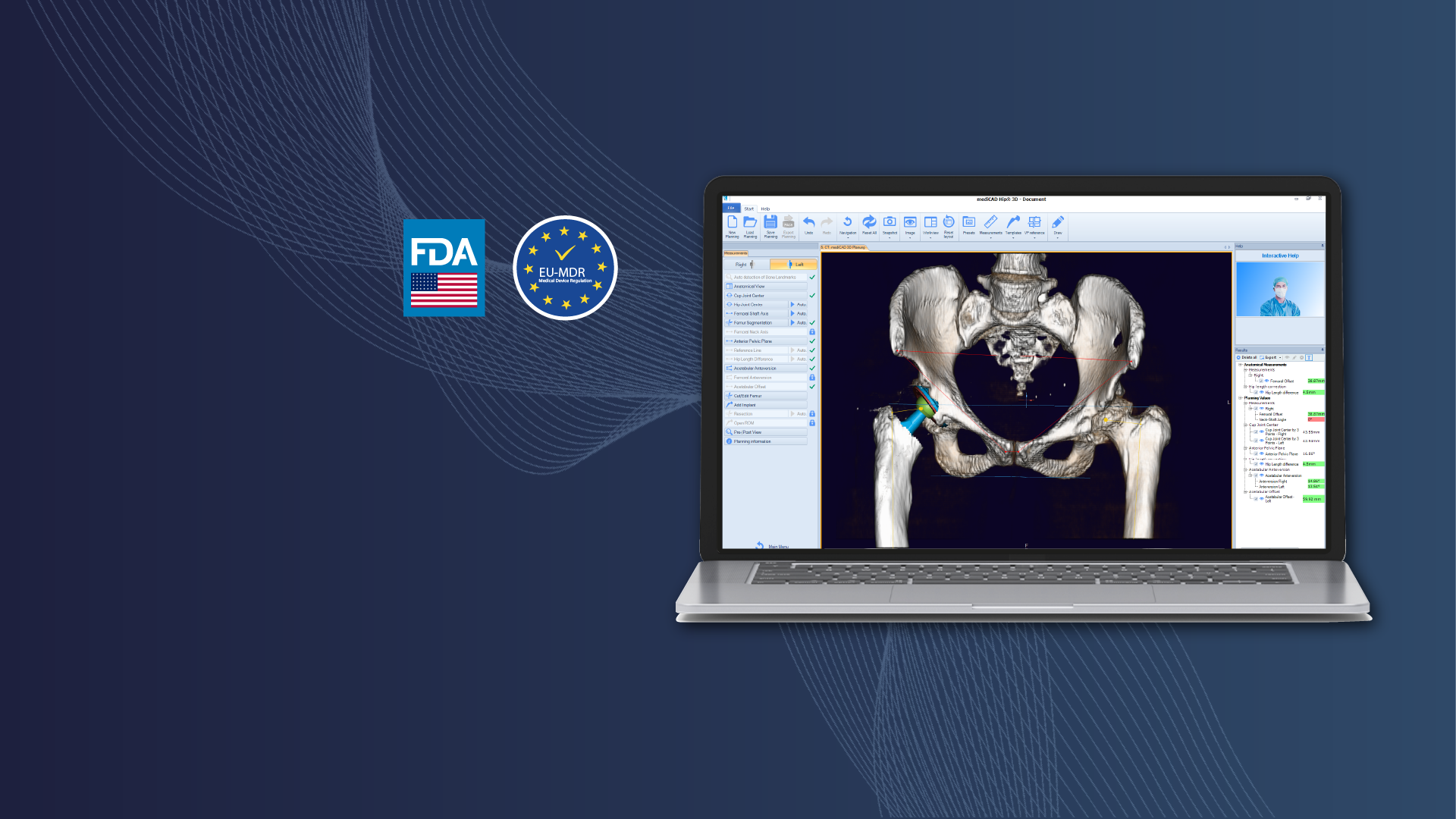 mediCAD Premium Orthopaedic Software Solutions - Homepage
